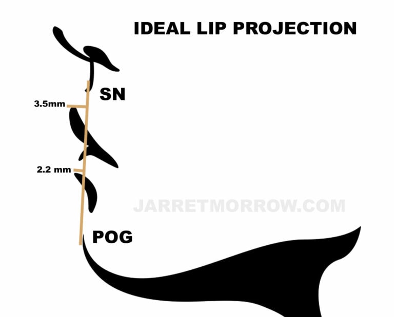 What Is the Ideal Lip Ratio? - Dr. Jarret Morrow