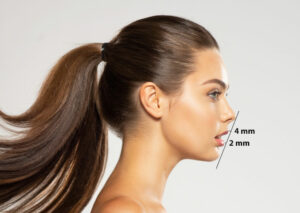 Ricketts’ E-line in Assessing Facial Beauty - Dr. Jarret Morrow